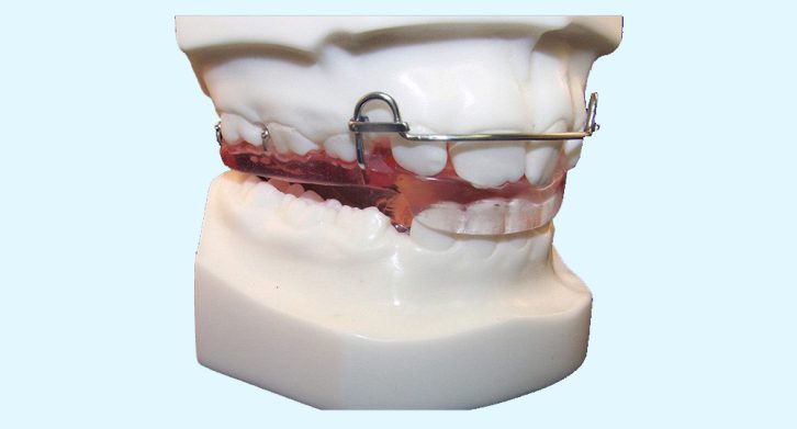 دستگاه های فانکشنال دستگاه فانکشنال ارتودنسی - دکتر جمیلیان