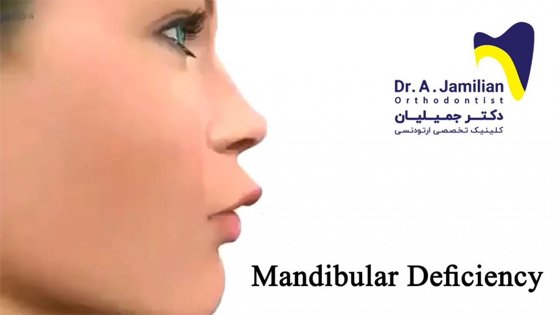 Mandible Deficiency - Mandible syndrome - Dr Jamilian