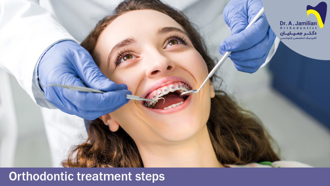 Orthodontic Treatment Steps - Dr Jamilian