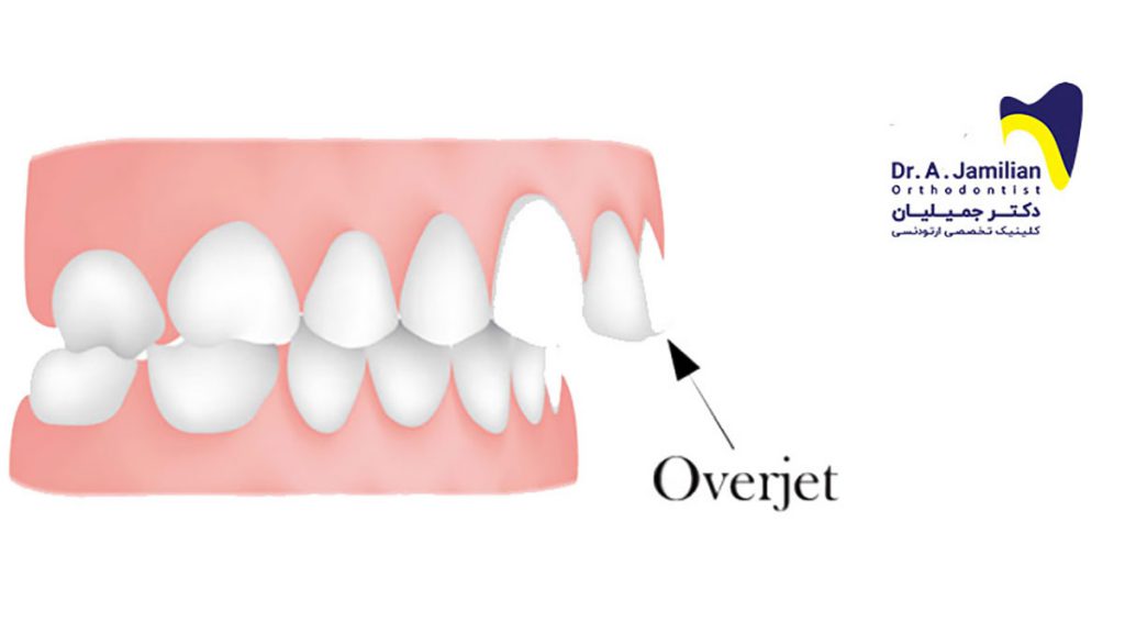 Non Simple Malocclusions - Dr Jamilian