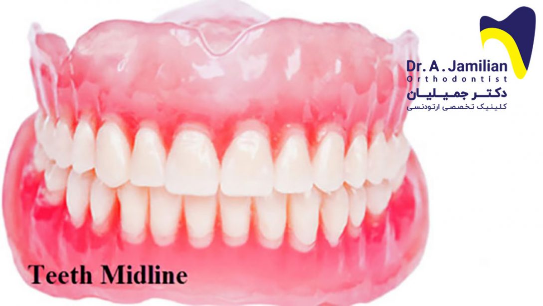 Midline discrepancy - Dr Jamilian