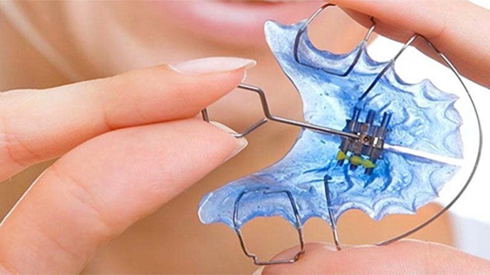 What is Removable Orthodontic Appliances - Dr Jamilian