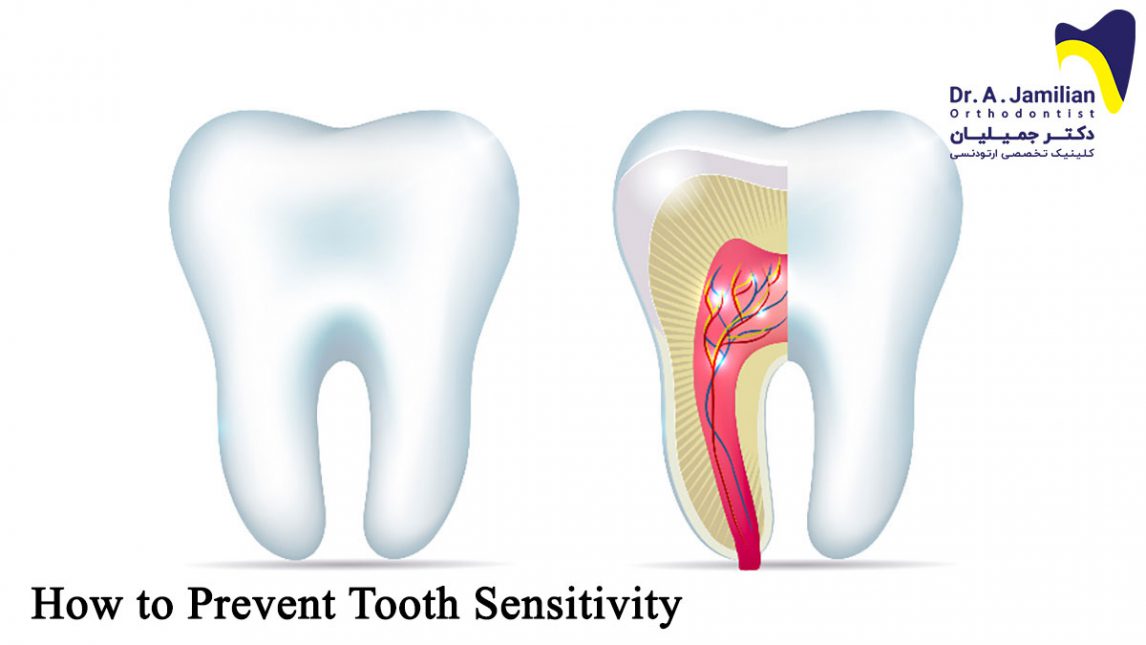 How to Treat Tooth Hypersensitivity - Dr Jamilian