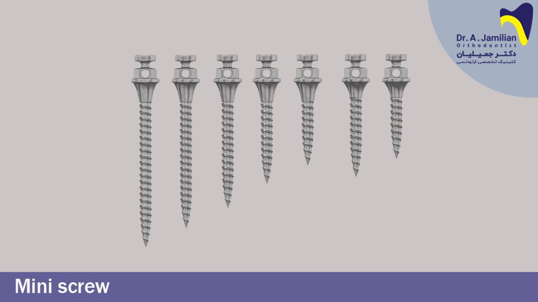 Mini screw - Dr jamilian