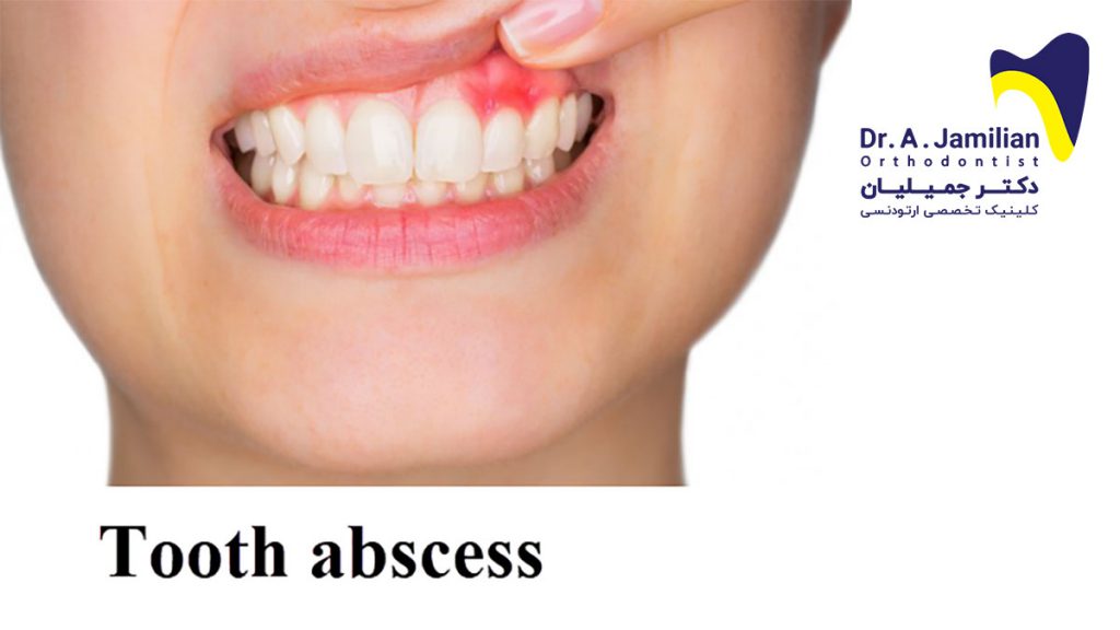 Root Canal and Gum Problems Dentistry - Dr Jamilian Orthodontist Root Canal and Gum Problems Dentistry - Dr Jamilian Orthodontist