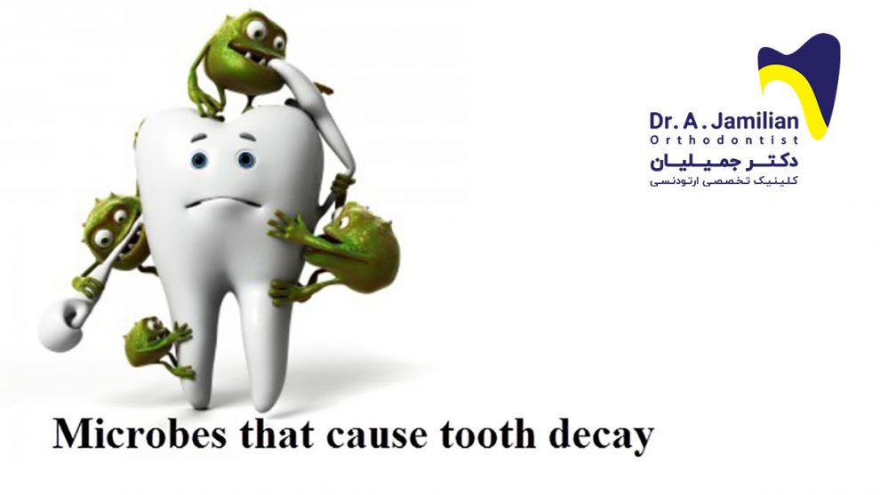 Microbes that cause tooth decay - Dr Jamilian
