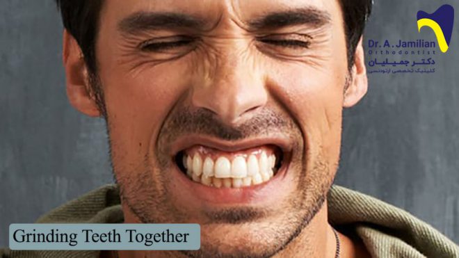 Grinding teeth together - Dr Jamilian
