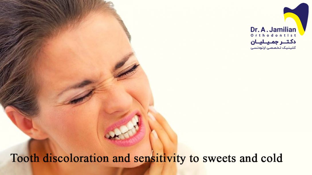 Tooth discoloration and sensitivity to sweets and cold - Dr Jamilian