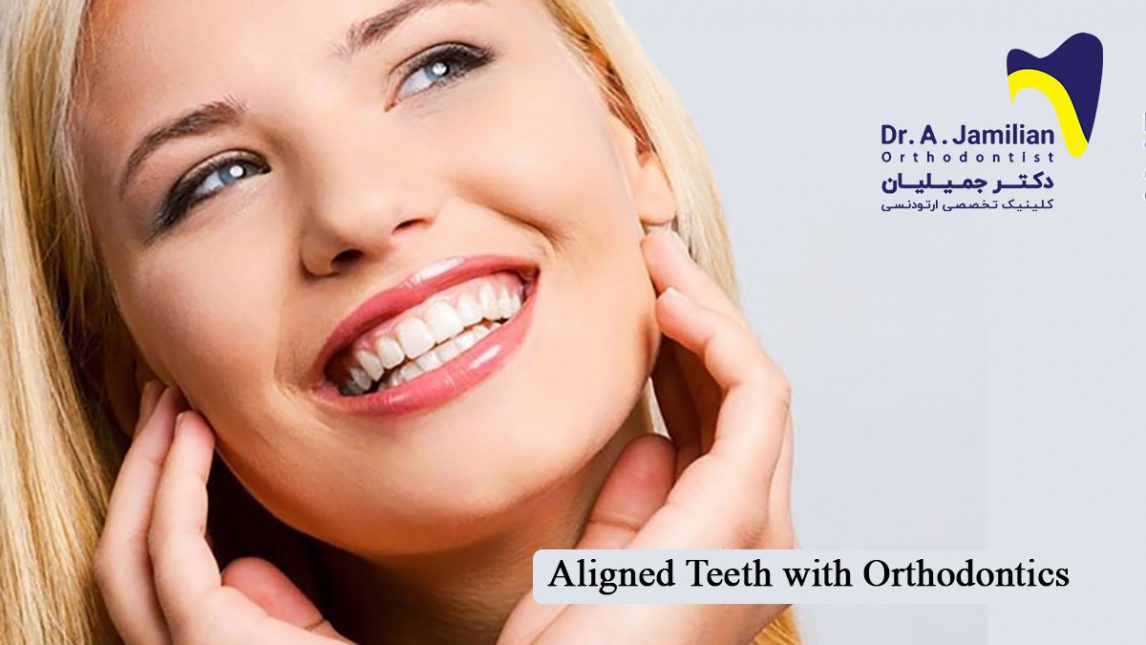 Aligned teeth with orthodontics - Dr Jamilian