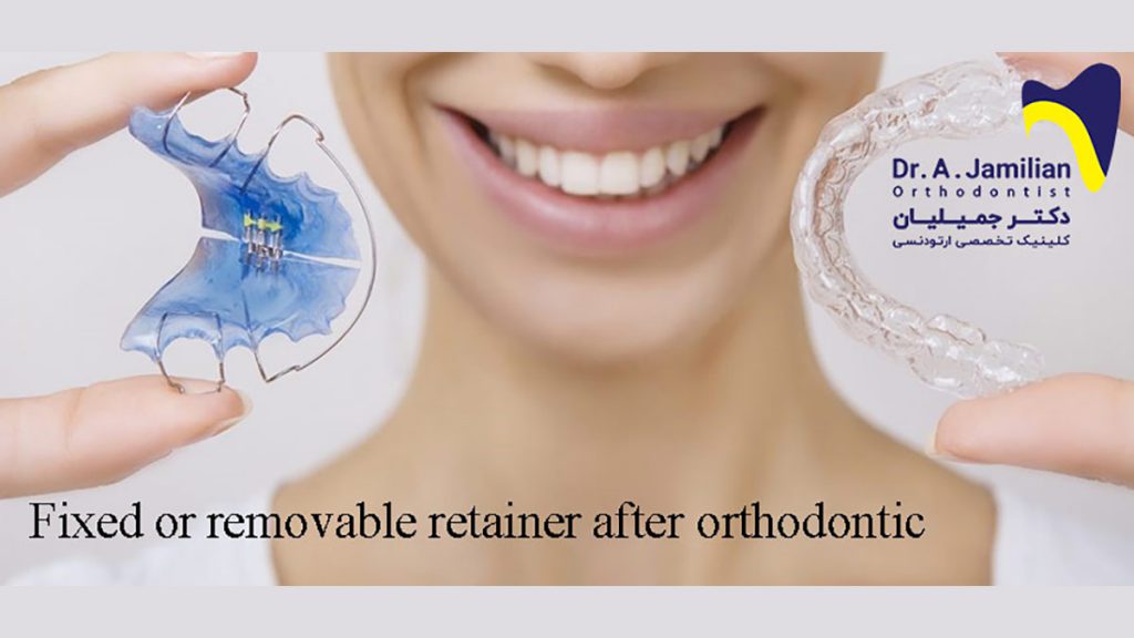 Fixed or removable retainer after orthodontic - Dr Jamilian