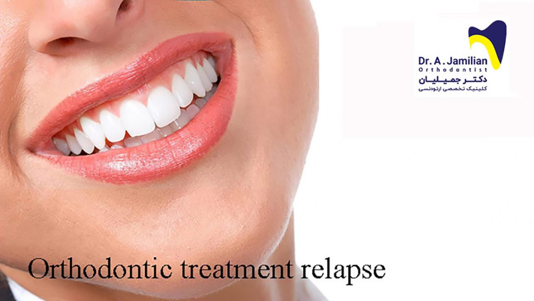 Orthodontic treatment relapse - Dr Jamilian