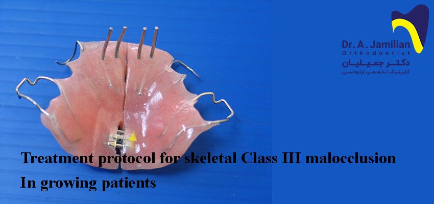 Treatment Protocol For Skeletal Class Iii Malocclusion In Growing Patients کلینیک ارتودنسی
