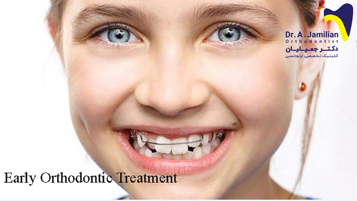 Why to do early orthodontic treatment? - Dr. Jamilian