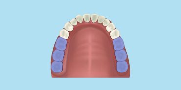 What is a molar teeth? - Dr Jamilian