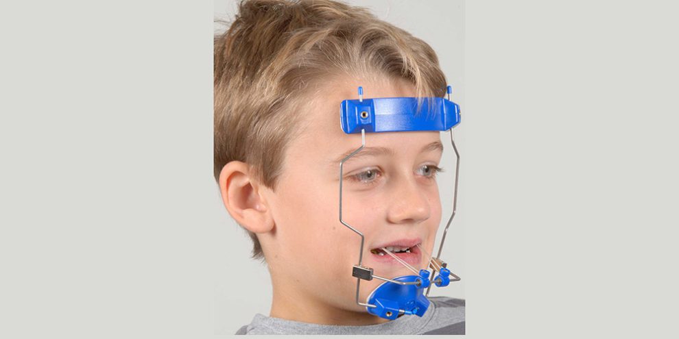 Learn more about maxillary orthodontics - Dr Jamilian