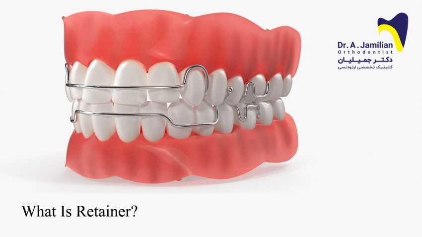 What is a retainer? - Dr Jamilian