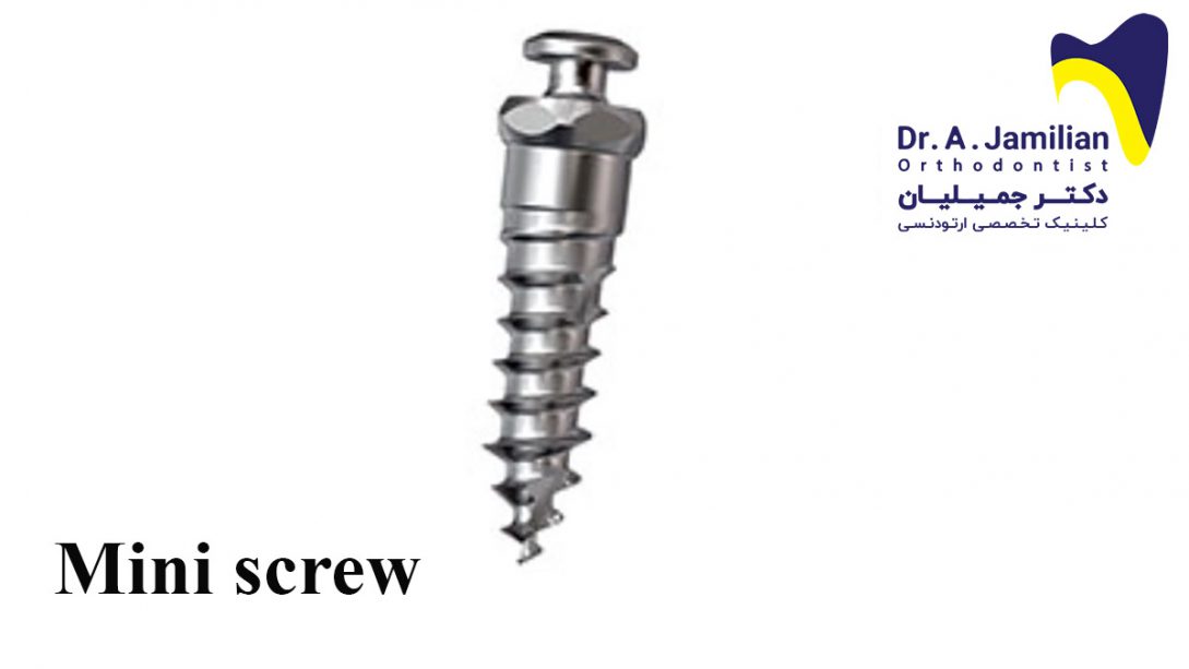 Mini screw - Dr jamilian