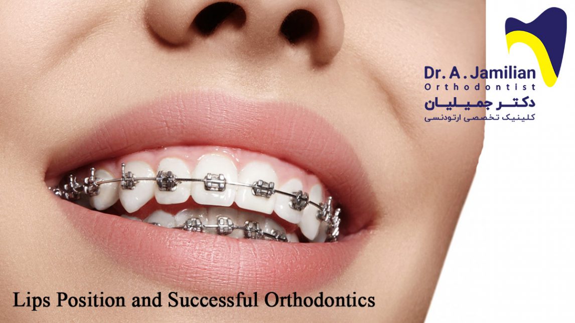 Lips position and successful orthodontics - Dr Jamilian