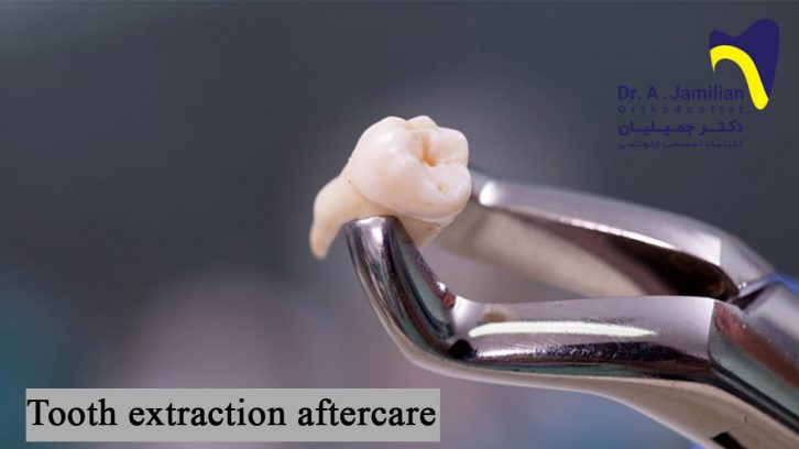 Tooth Extraction Aftercare - Dr Jamilian