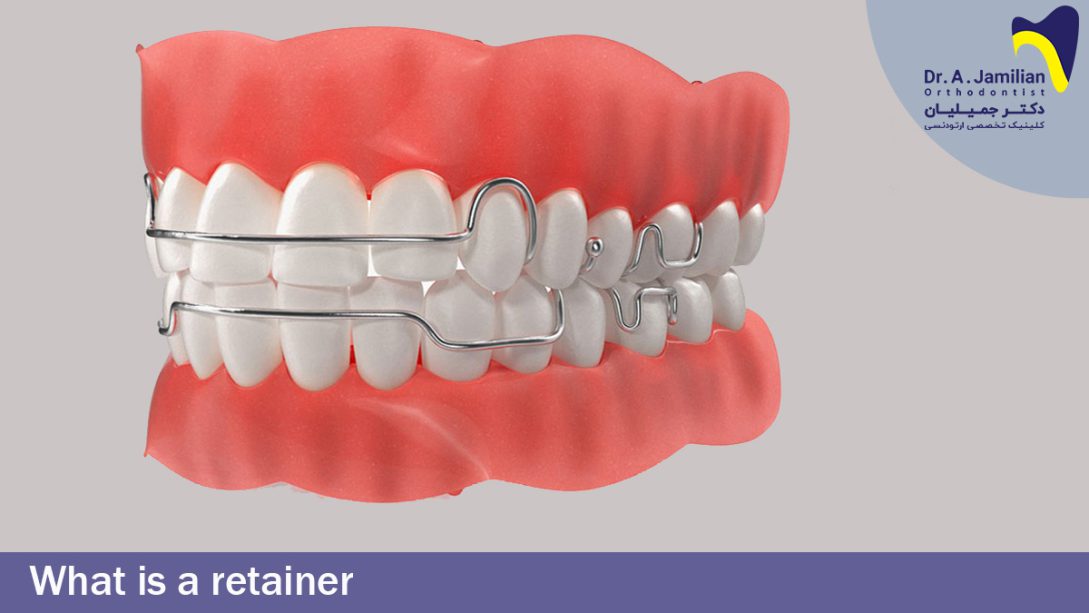 What Is A Retainer? - Dr Jamilian