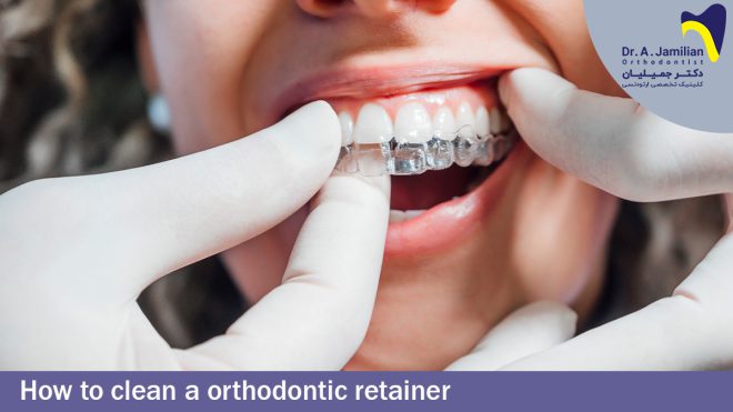 How to clean a orthodontic retainer - Dr Jamilian