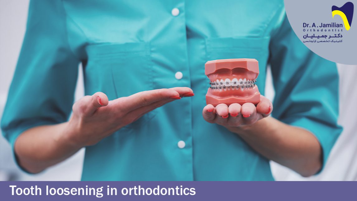 Tooth loosening in orthodontics - Dr Jamilian