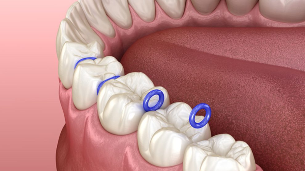 Orthodontic Instruments and Devices - Dr Jamilian