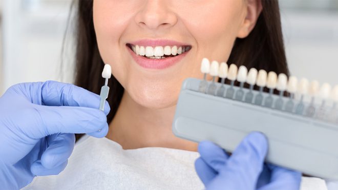 caring methods for dental crowns - Dr Jamilian