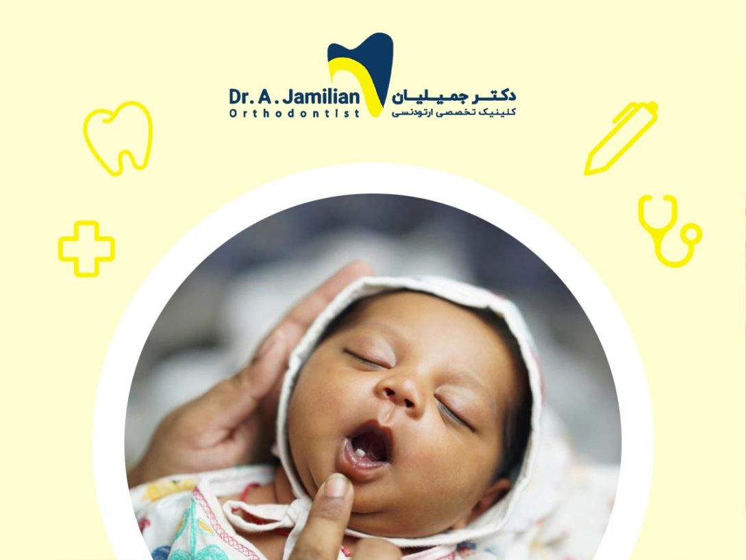 Everything you need to know about natal teeth - دکتر جمیلیان