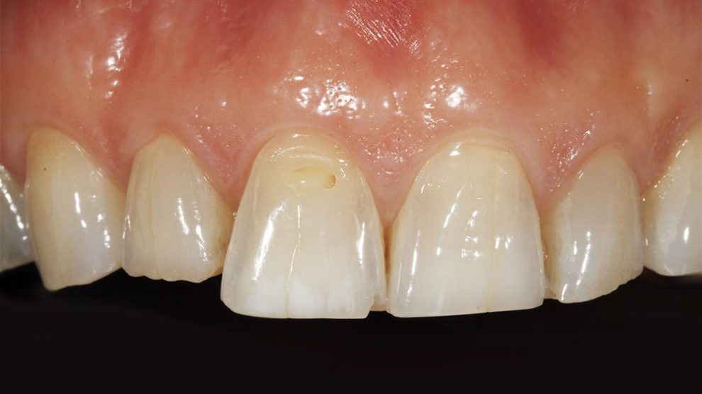 Everything you need to know about the enamel - Dr Jamilian