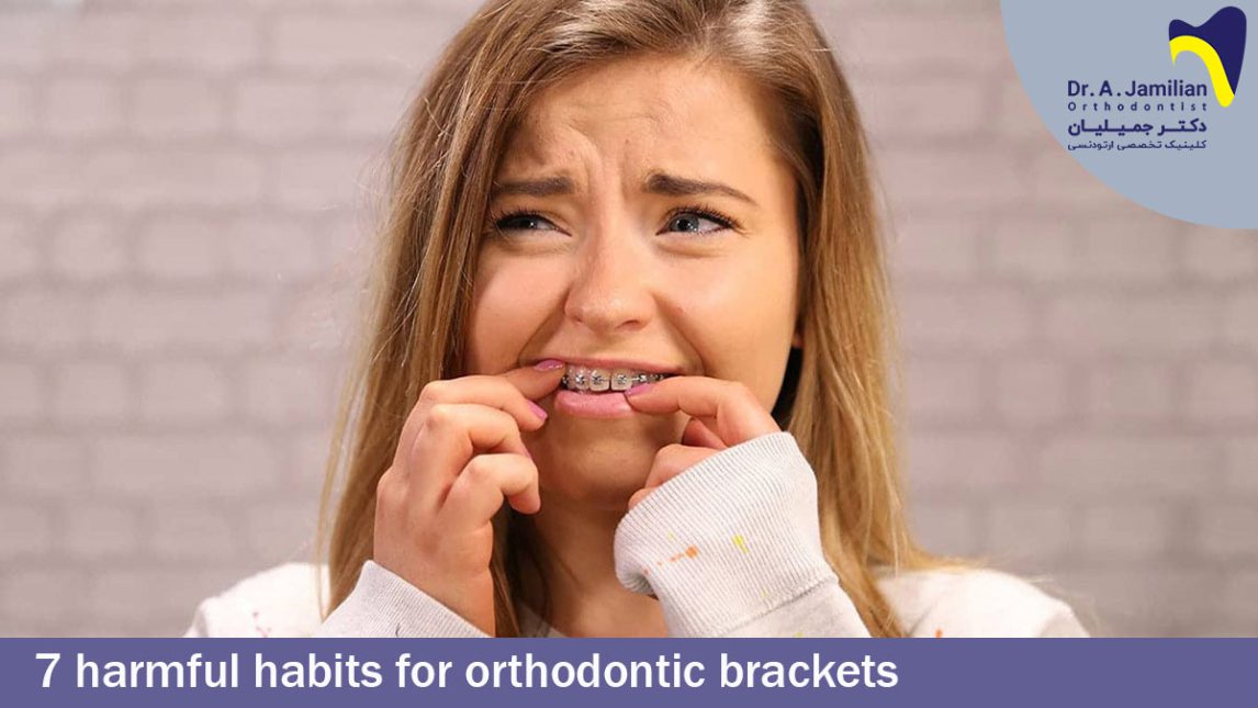 7 Bad Habits for Orthodontic Brackets Do's and Don'ts - Dr Jamilian